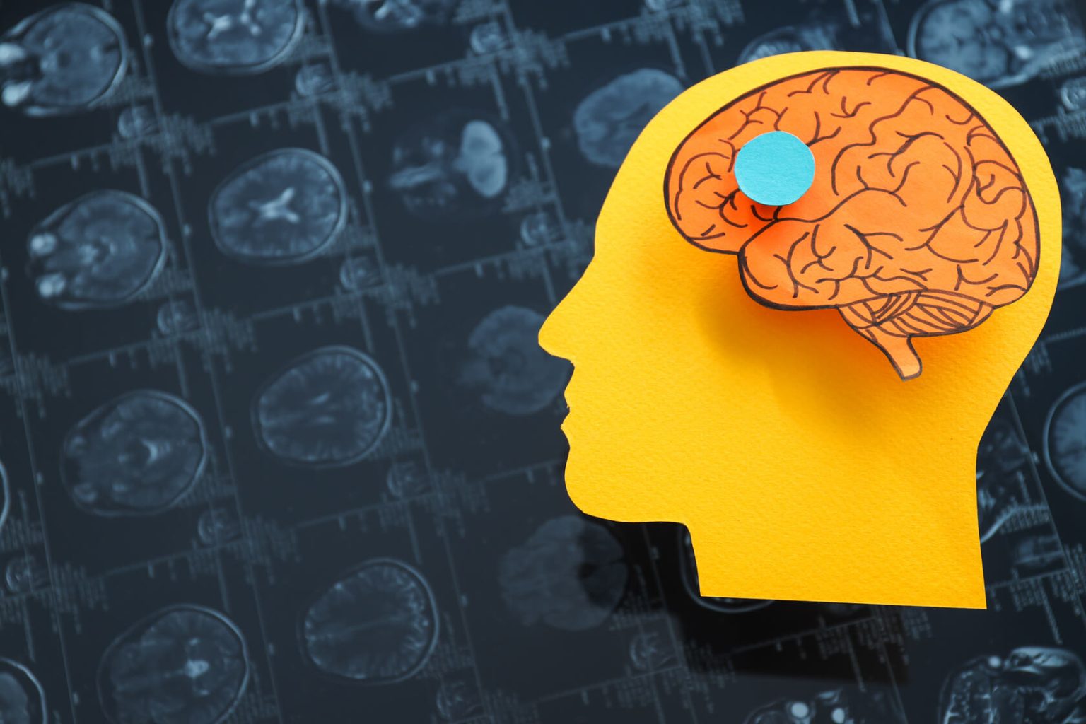How to Use Left and Right Brain Strategies to Secure Funding For Your Startup - Dale Ventures